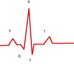 EKG Facts | Aviation Week